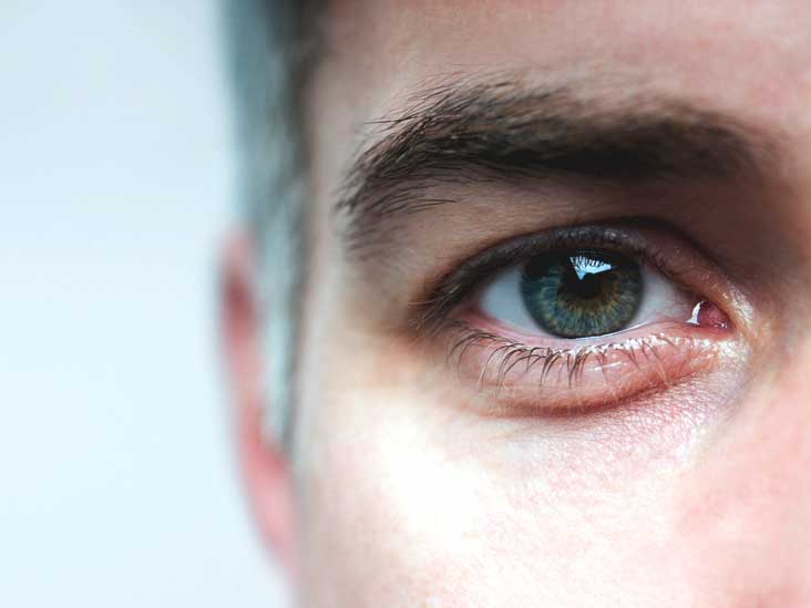 Mydriasis Causes Treatment And More