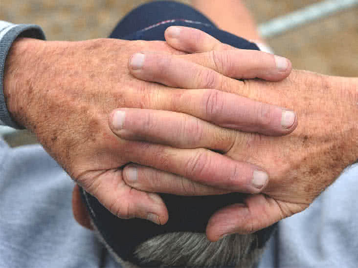 Hyperkeratosis: Epidermolytic, Follicular, Pilaris, and More