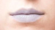 Blue Lips: Causes, Photos, and Treatments