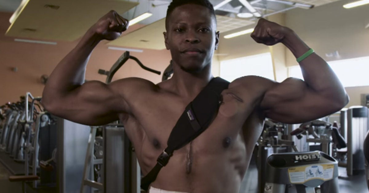 Fitness Model Doesn't Let an Artificial Heart Stop Him From Working Out