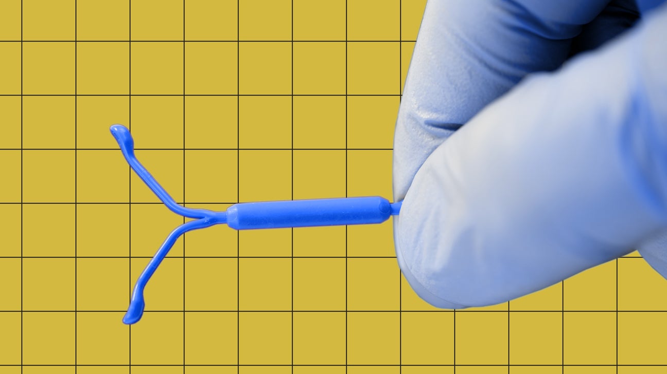 Mirena Side Effects: After Insertions and 3 Years