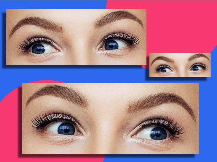 Hypervigilance: Symptoms, Causes, and Treatment