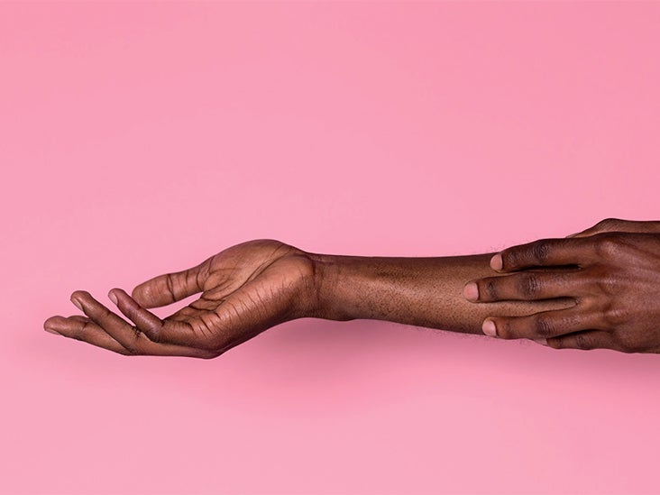 Hidradenitis Suppurativa vs. Boils: What’s the Difference?