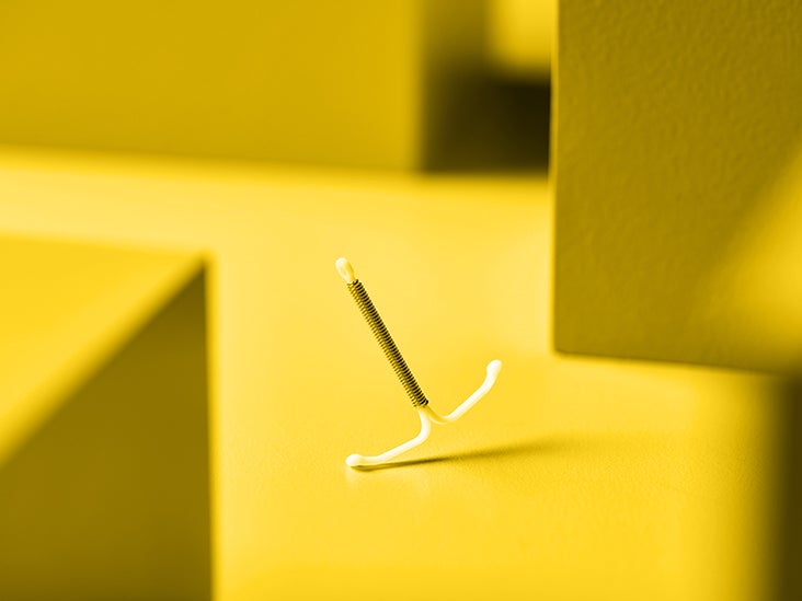Do You Know These IUD Myths?