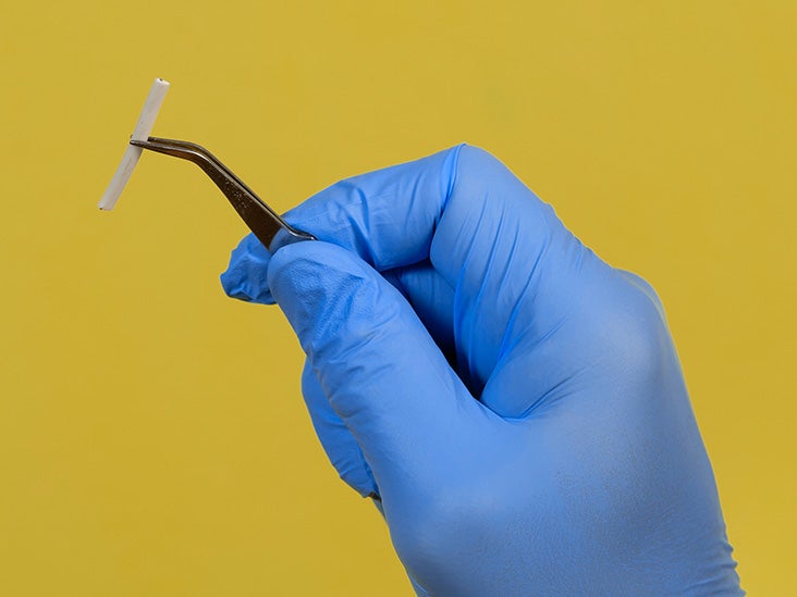 Birth Control Implant and Weight Gain: Just the Facts