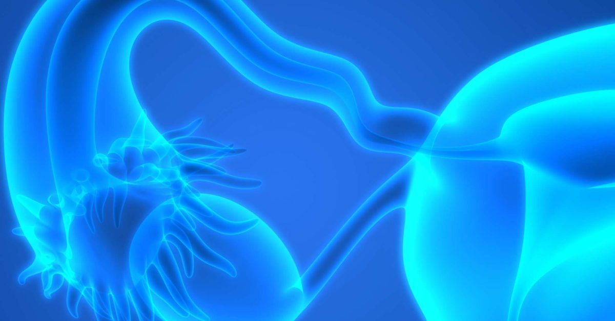 Salpingo-oophorectomy: Overview, procedure, and recovery