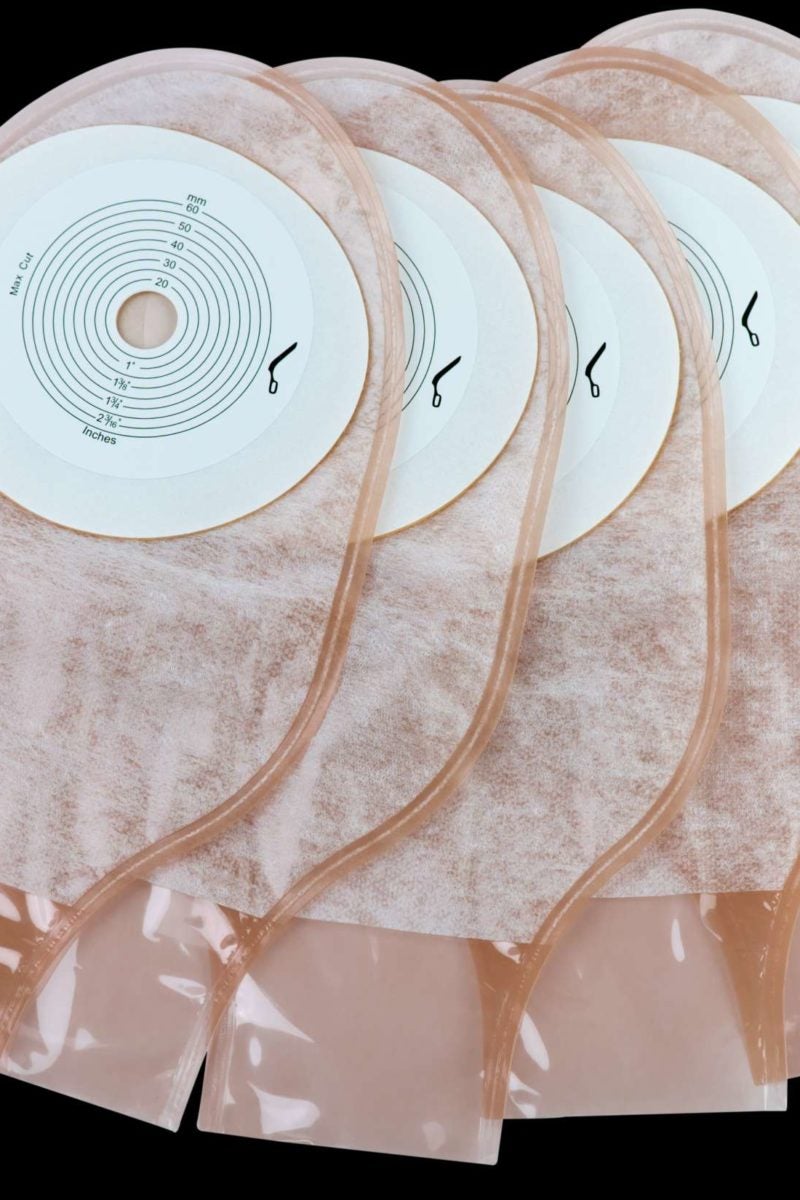 Ileostomy: Preparation, recovery, and what to expect