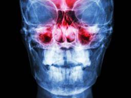 Sinus surgery: Types, recovery, risks, and alternatives